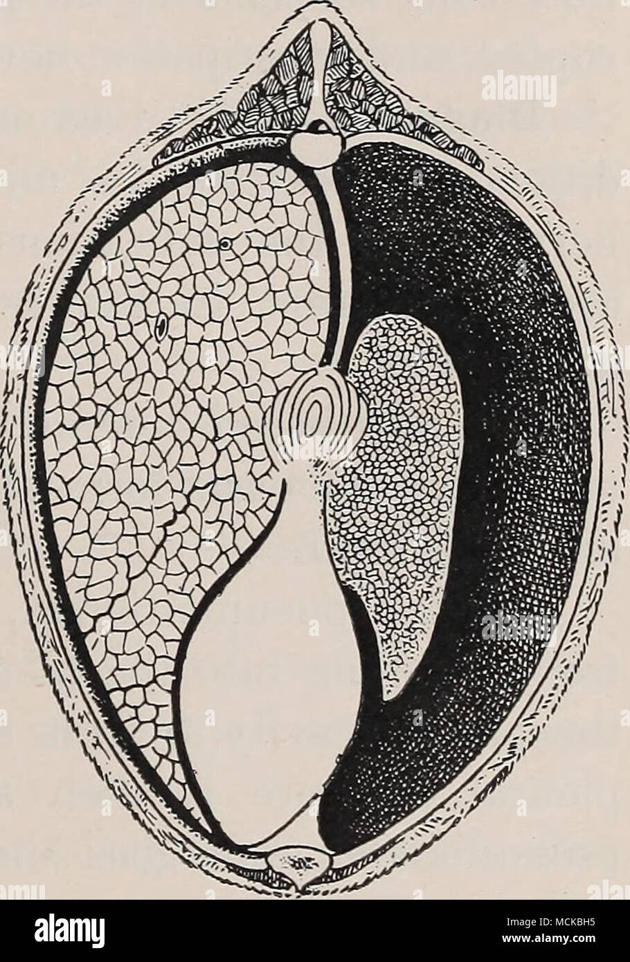 . Fig. 171.—Schema illustrating open pneumo-thorax. Right lung col ...