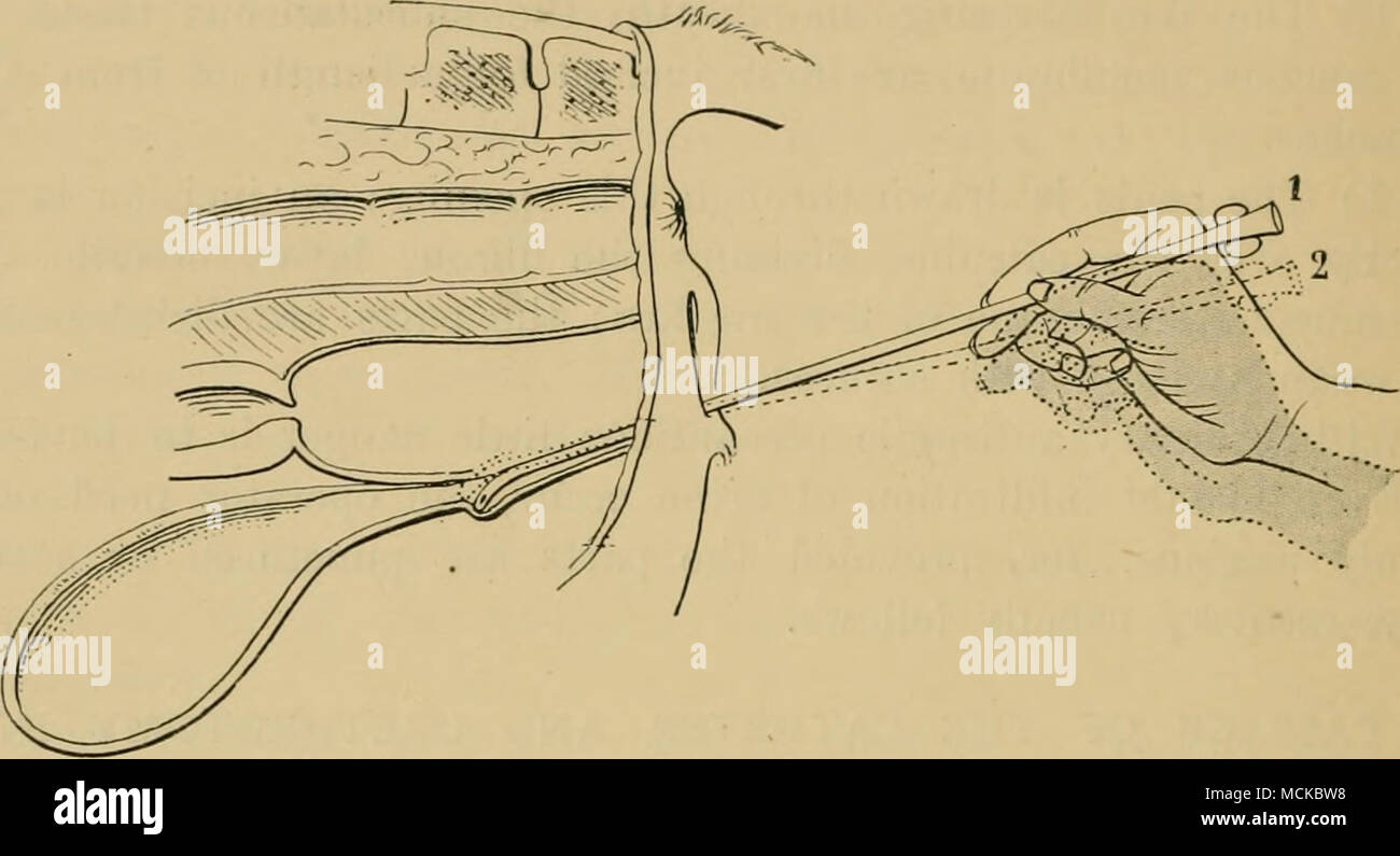 . Fig. 307.—Passing the catheter in the cow. the obstruction is about ...