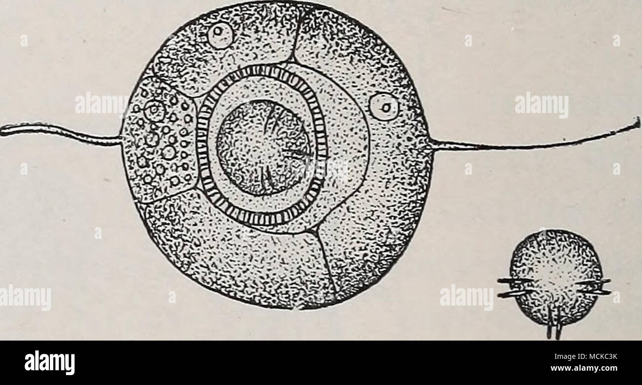 Trichinosis High Resolution Stock Photography and Images - Alamy