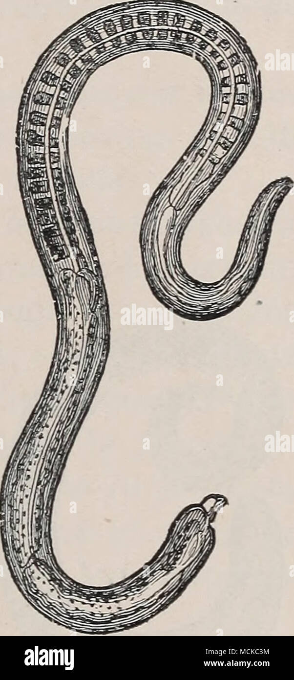 Trichina hi-res stock photography and images - Alamy