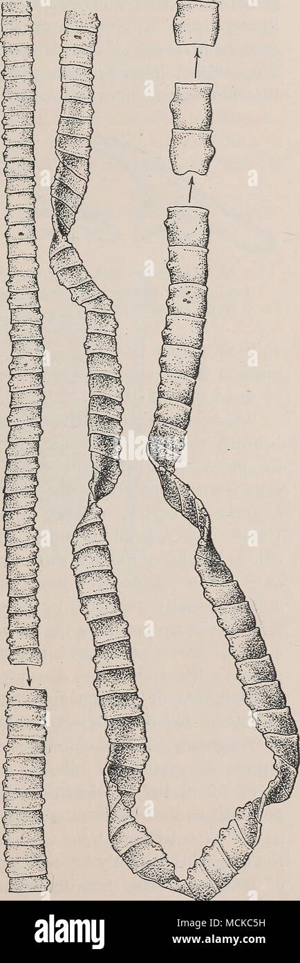 Pork Tapeworm Stock Photos & Pork Tapeworm Stock Images - Alamy