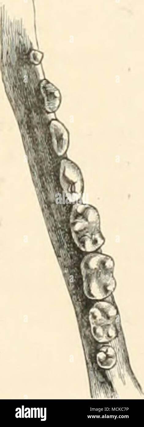 . Upper molar teeth (right side). Lower molar teeth (right side). (All ...