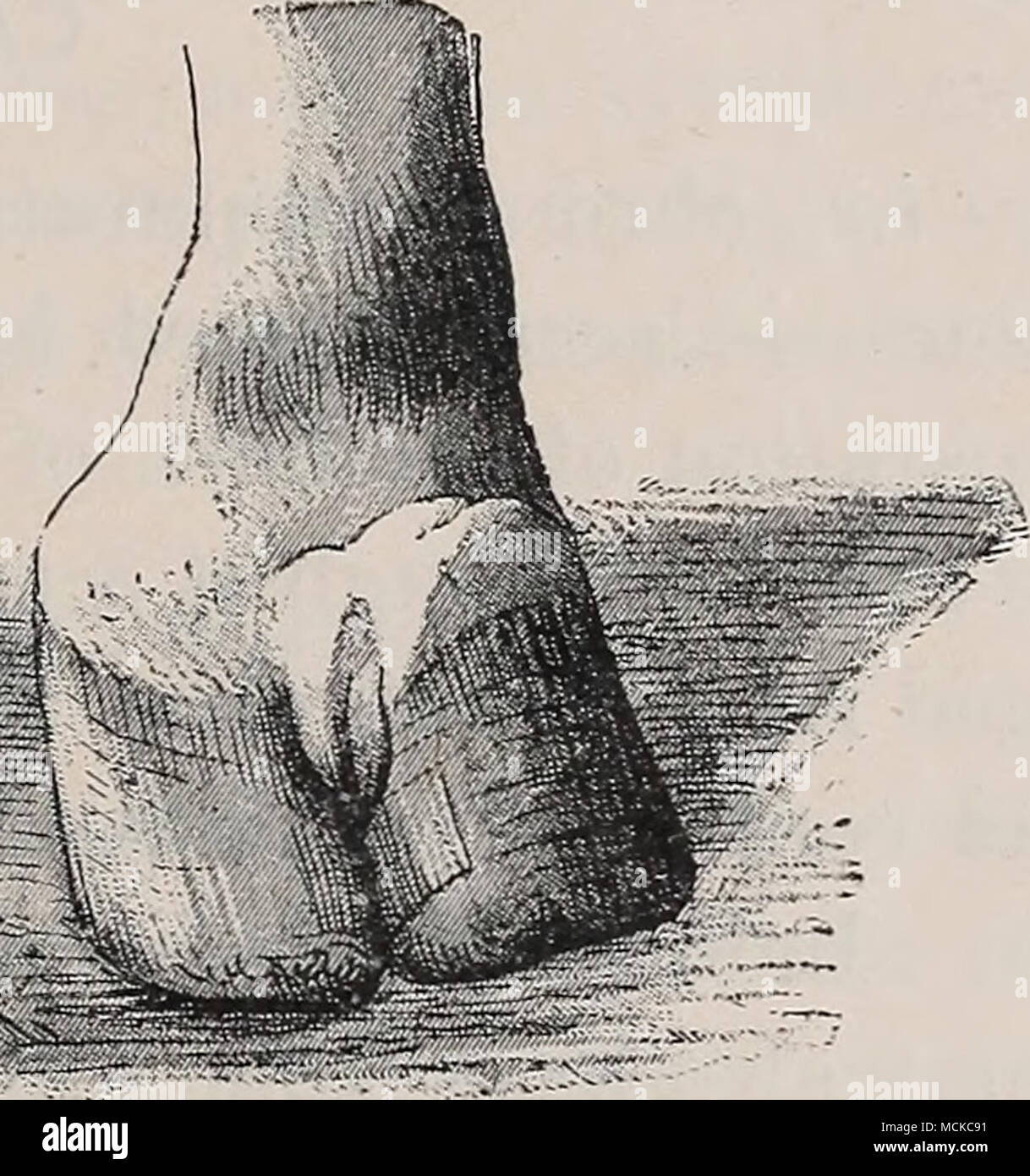 . Fig. 16.—Condylomata of the interdigital space and sidebones ...