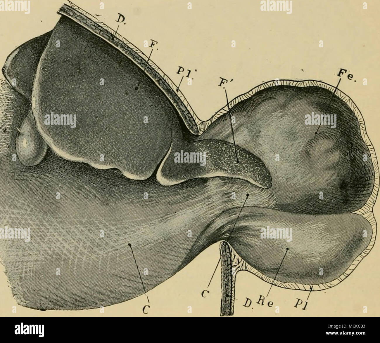 Diaphragmatic rupture hi-res stock photography and images - Alamy