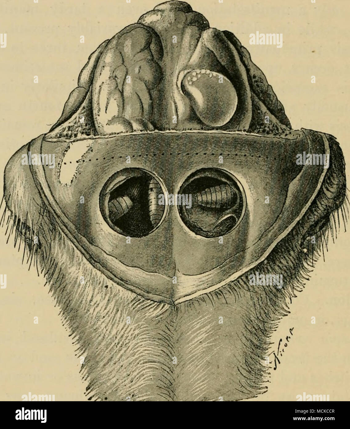 Larvae cysts brain hi-res stock photography and images - Alamy