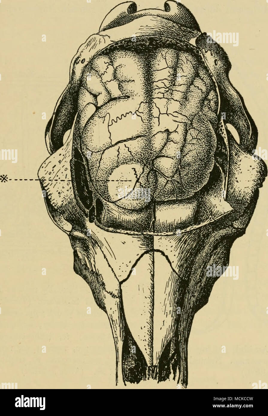 Bladder worm hi-res stock photography and images - Alamy