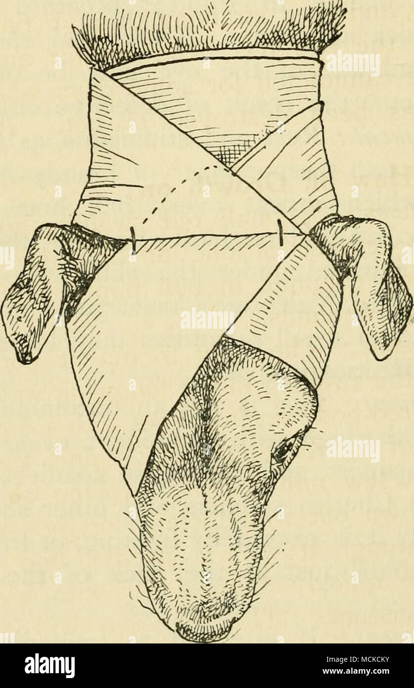 . How to apply a bandage to cover one eye sure return it. Afterwards ...