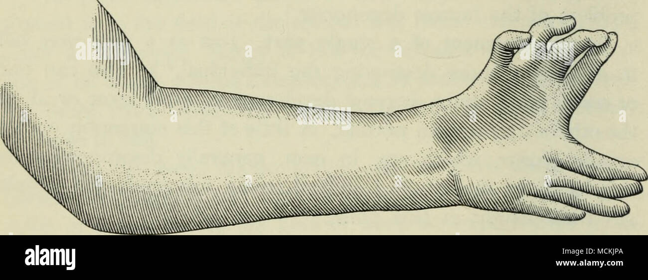 Snakes within snakes hi-res stock photography and images - Alamy