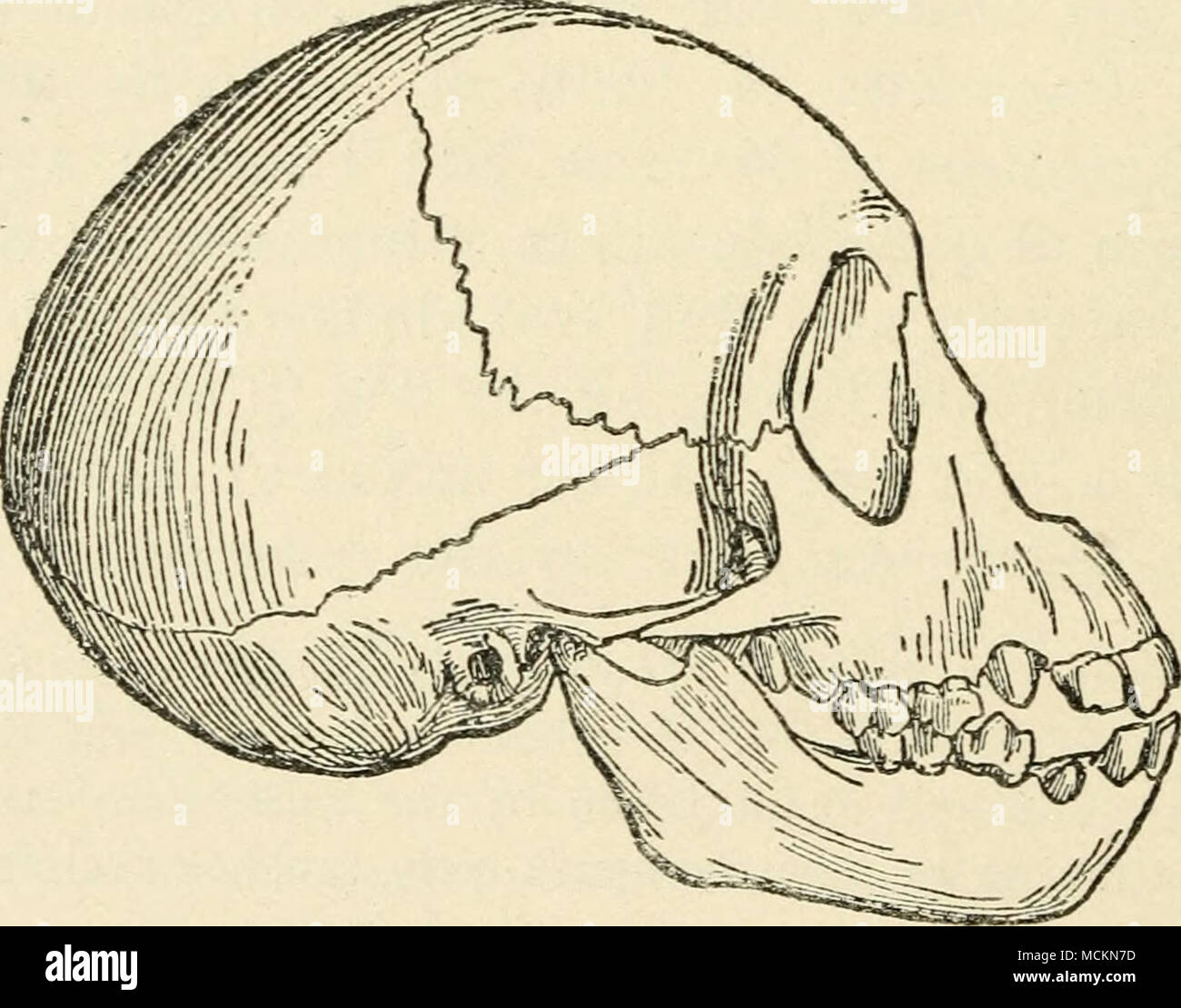 Piltdown hi-res stock photography and images - Alamy