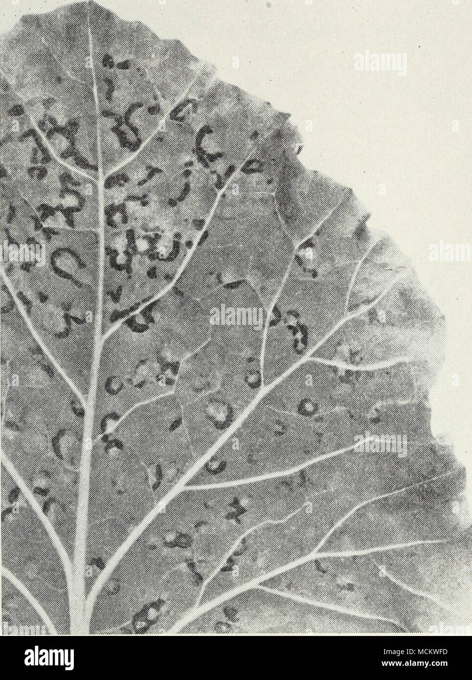 Black Ring Disease Ringworm (Tinea Corporis) Condition, Treatments And