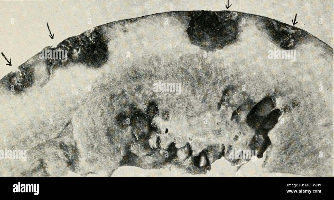 . Fig. II. Watermelon Slice Showing Hail Injury. Arrows In- dicate ...