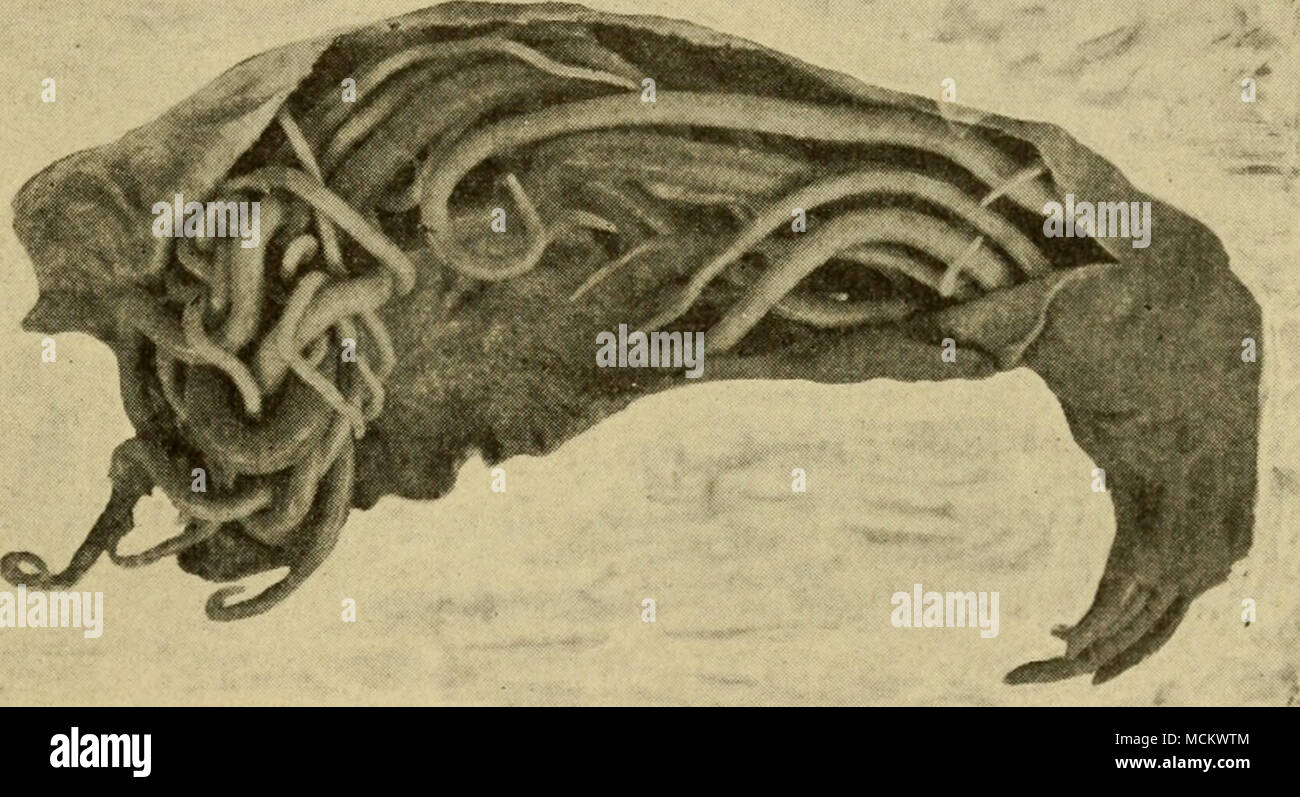 . FIG. 20—ROUND WORMS IN A PIECE OF INTESTINE Symptoms.—The symptoms ...