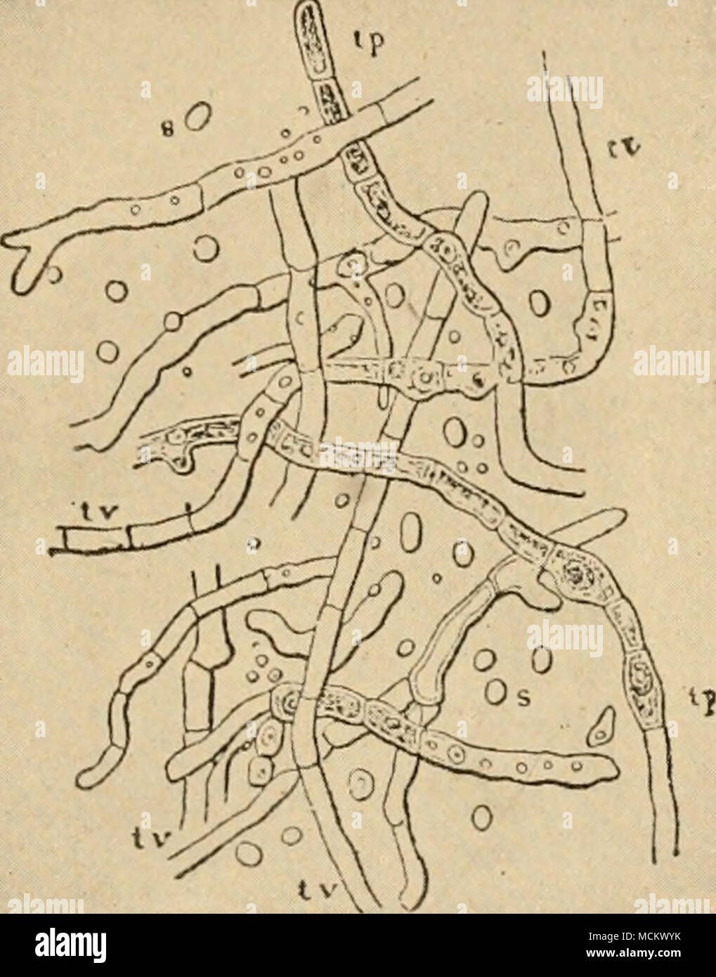 . Fig. 53. ââ The fungus Achorion schon- Icinii which causes favus in ...