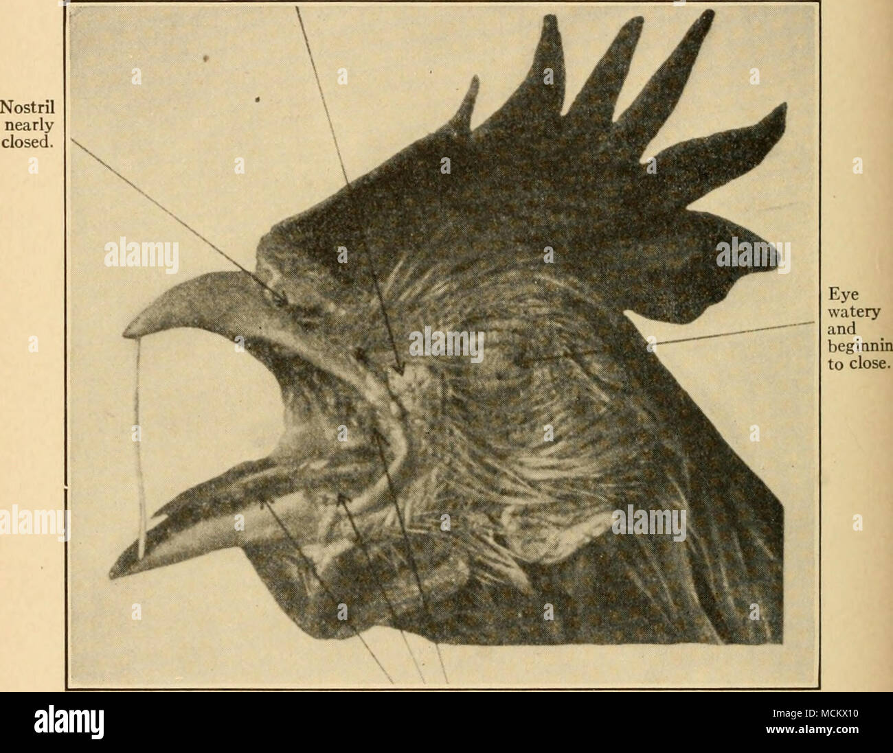 Fibrinous hi-res stock photography and images - Alamy