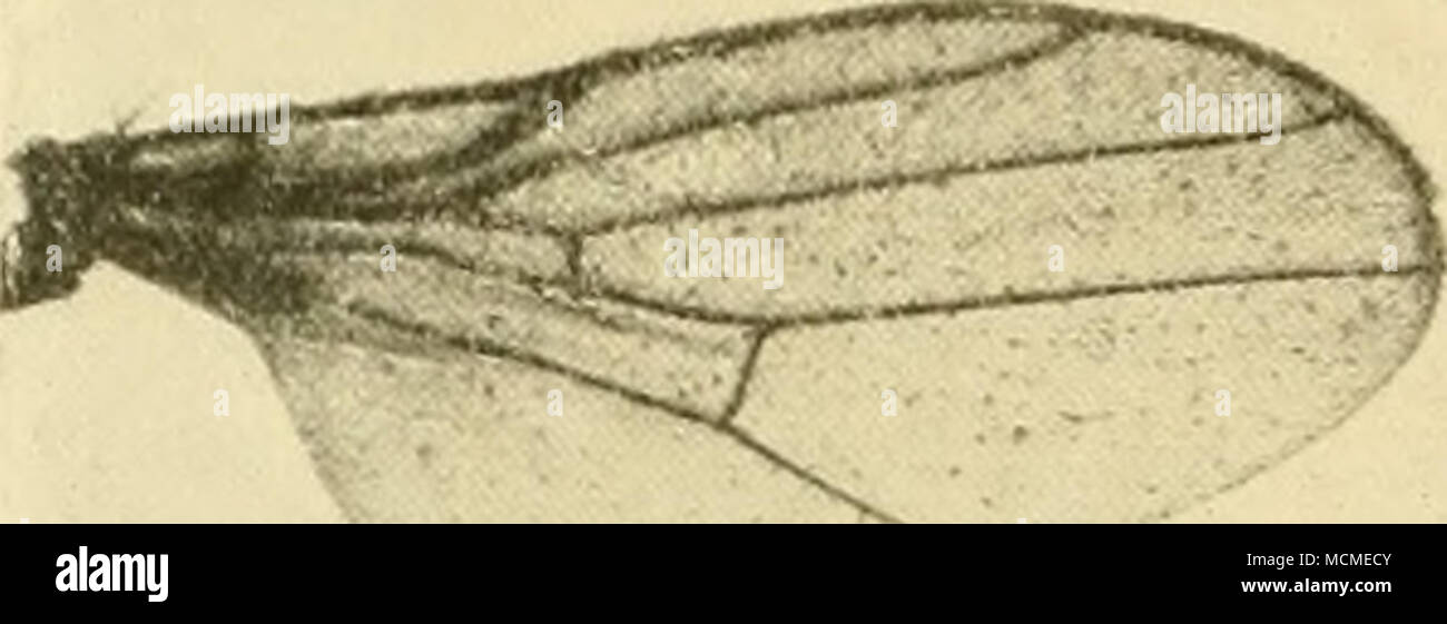 Tibial spurs hi-res stock photography and images - Alamy