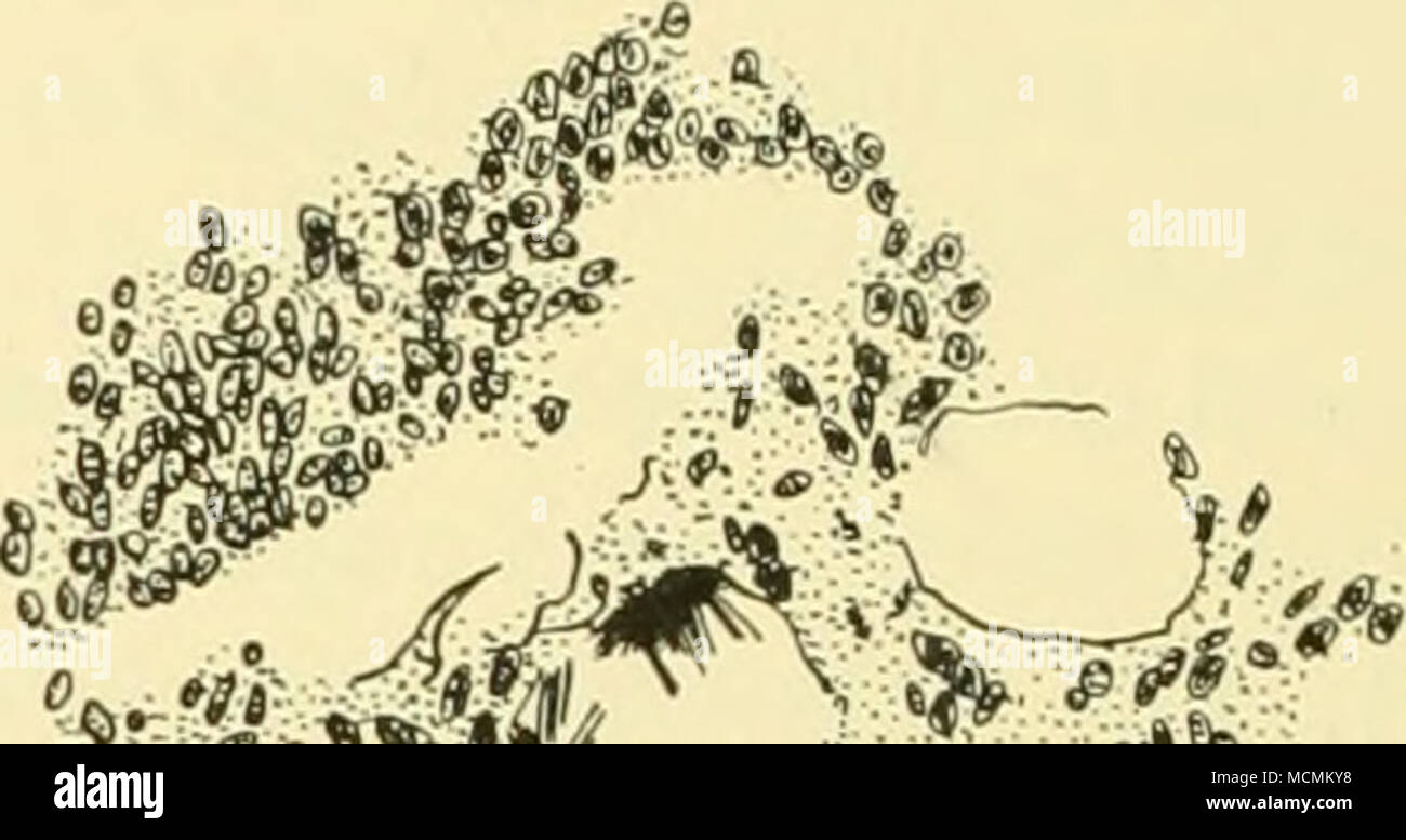. Fig. 113. Blubber cells with blood crystals at the edge of the ...