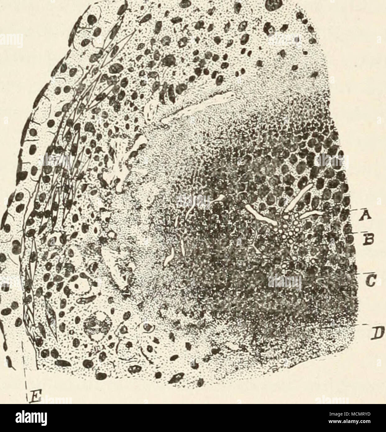 . Fig 88. Necrosis in the kidney of a rabbit due to A. funiigatus ; A ...