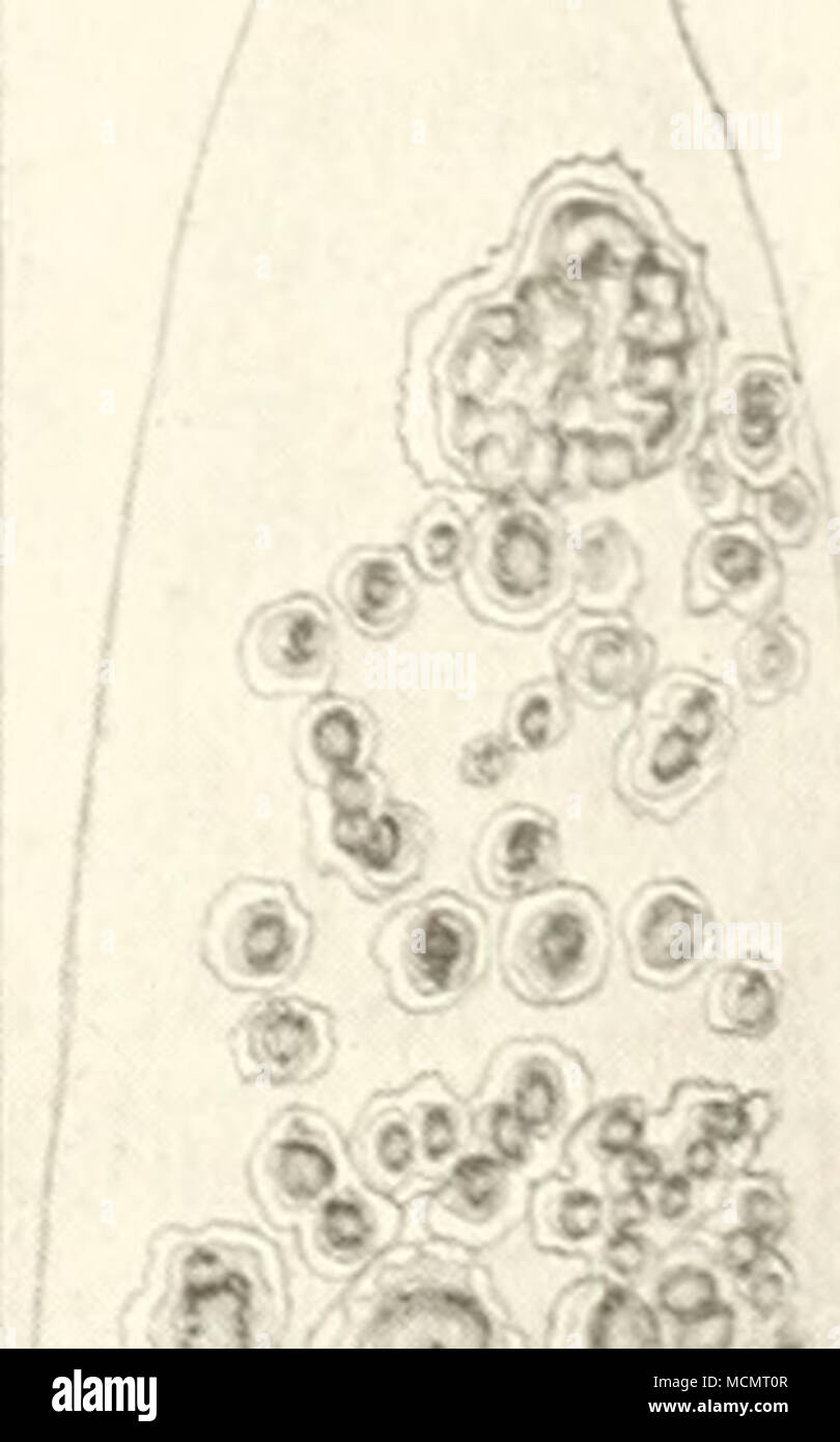 Tubercle bacteria hi-res stock photography and images - Alamy