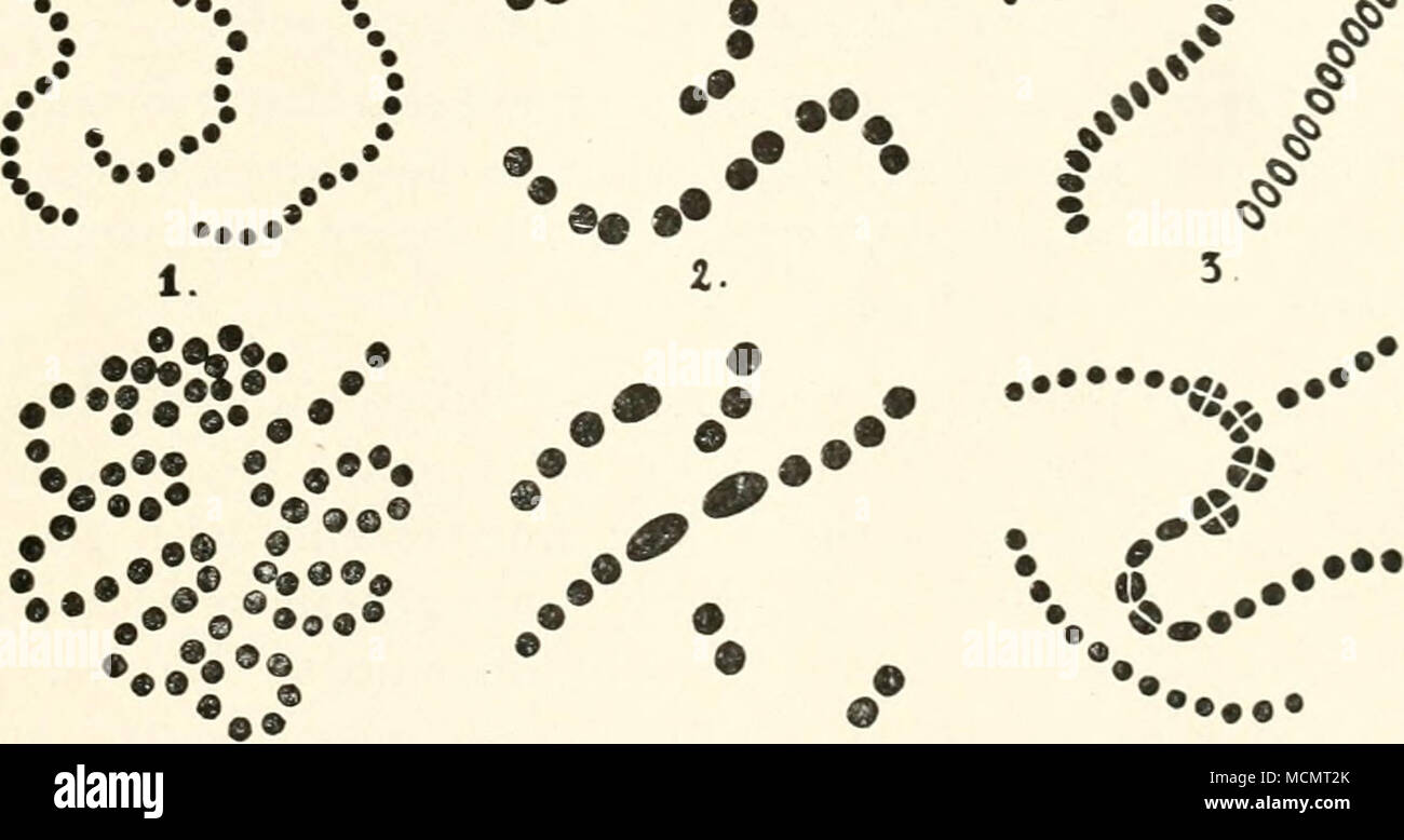 Streptococci chains hi-res stock photography and images - Alamy