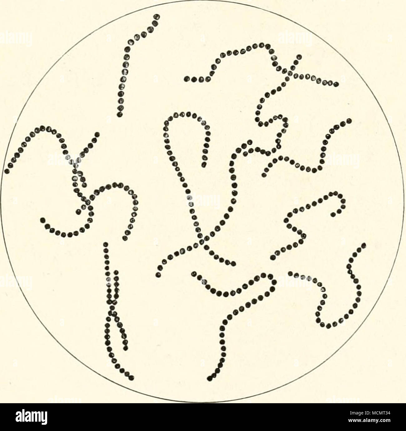 . Vie 3. Streptococcus pyogenes. Draiving made front a cover-glass ...