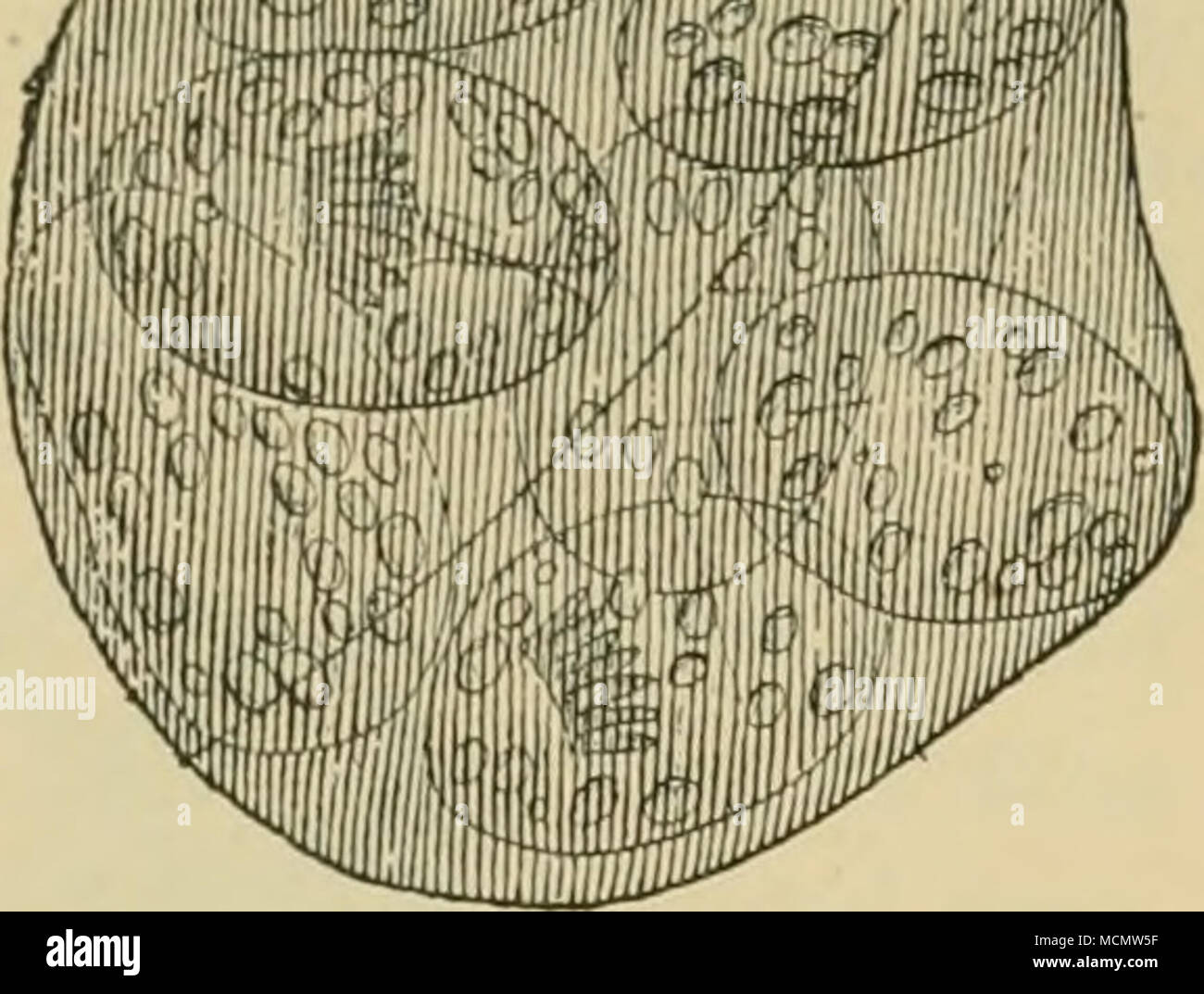 . Fio. 131.—Echinococcus bladder worm or hydatid. visceral lesion, but ...