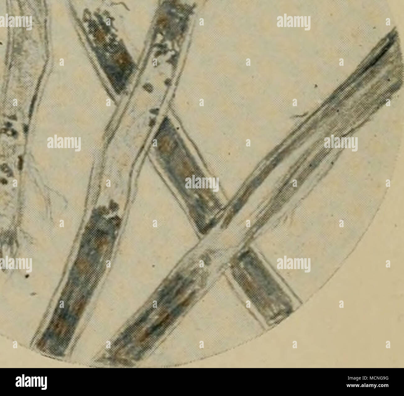 Trichorrhexis hi-res stock photography and images - Alamy