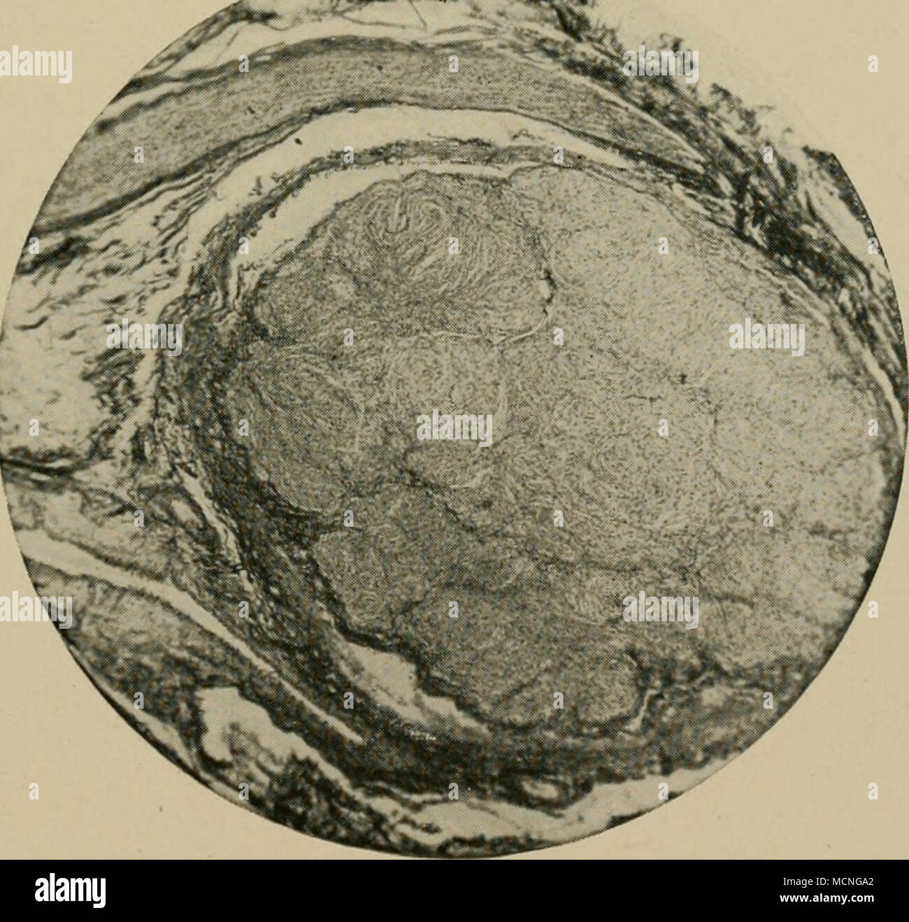 Neurom hi-res stock photography and images - Alamy