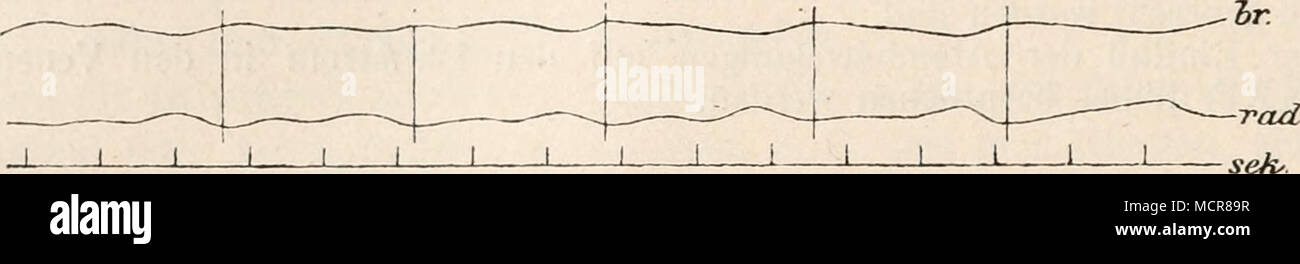 . Fig. 163. Die Bewegungen der Brustwand (Br.) durch den Herzschlag ...