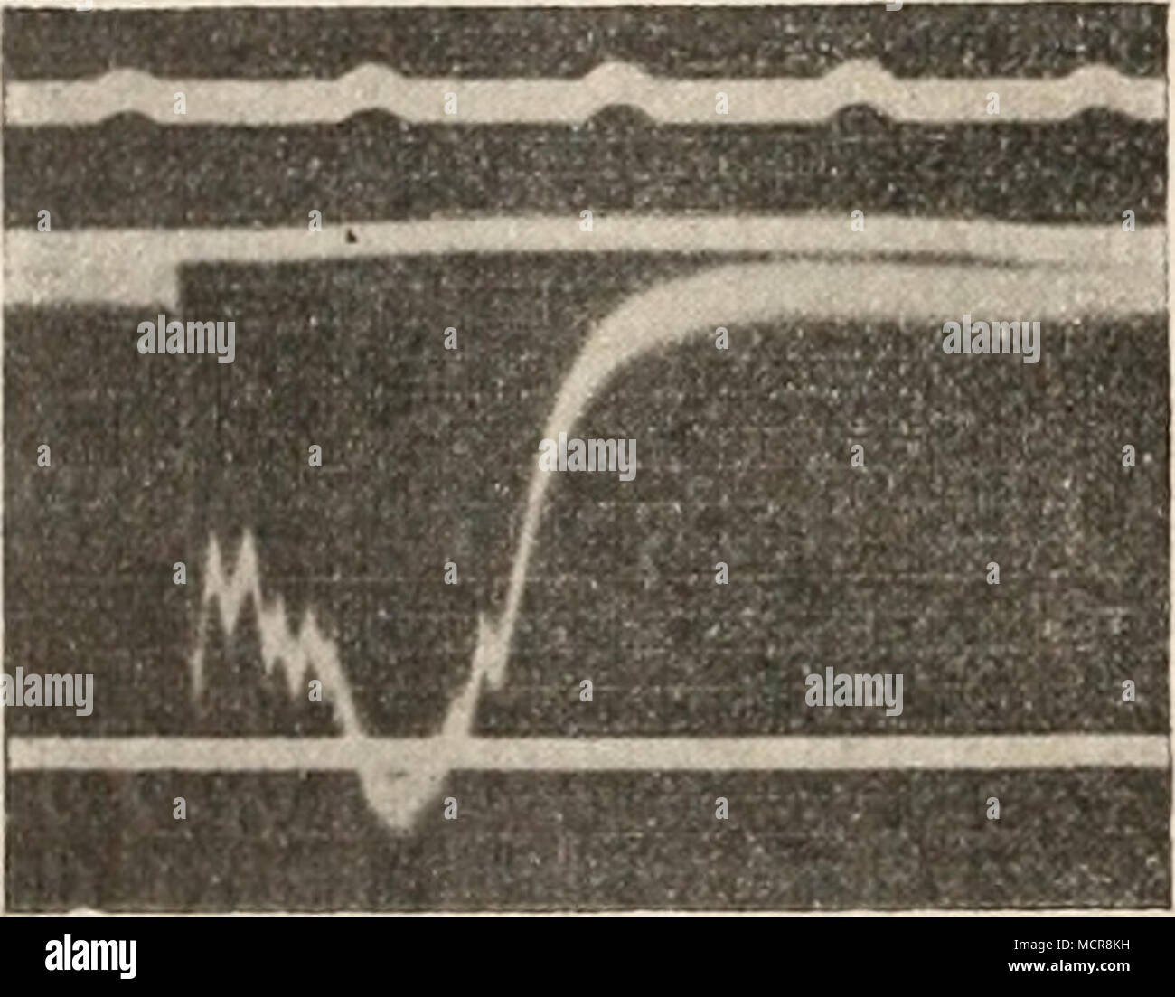 . 1 Cremer, Münch. med. Wochenschr., 1906, S. 811. 2 Foä, Giorn. della ...