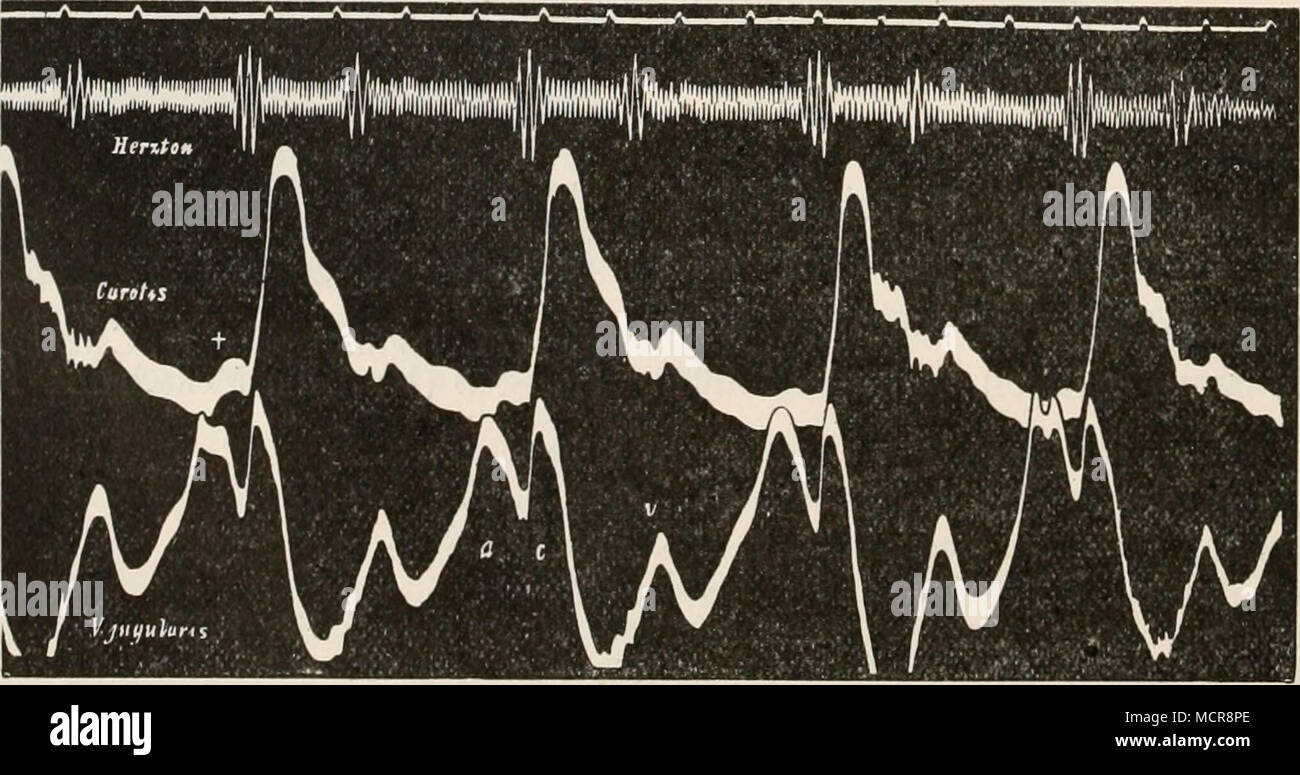 . d e j Fig. 478. Herztöne, Carotis- und Venenpuls. Nach Kapff und ...
