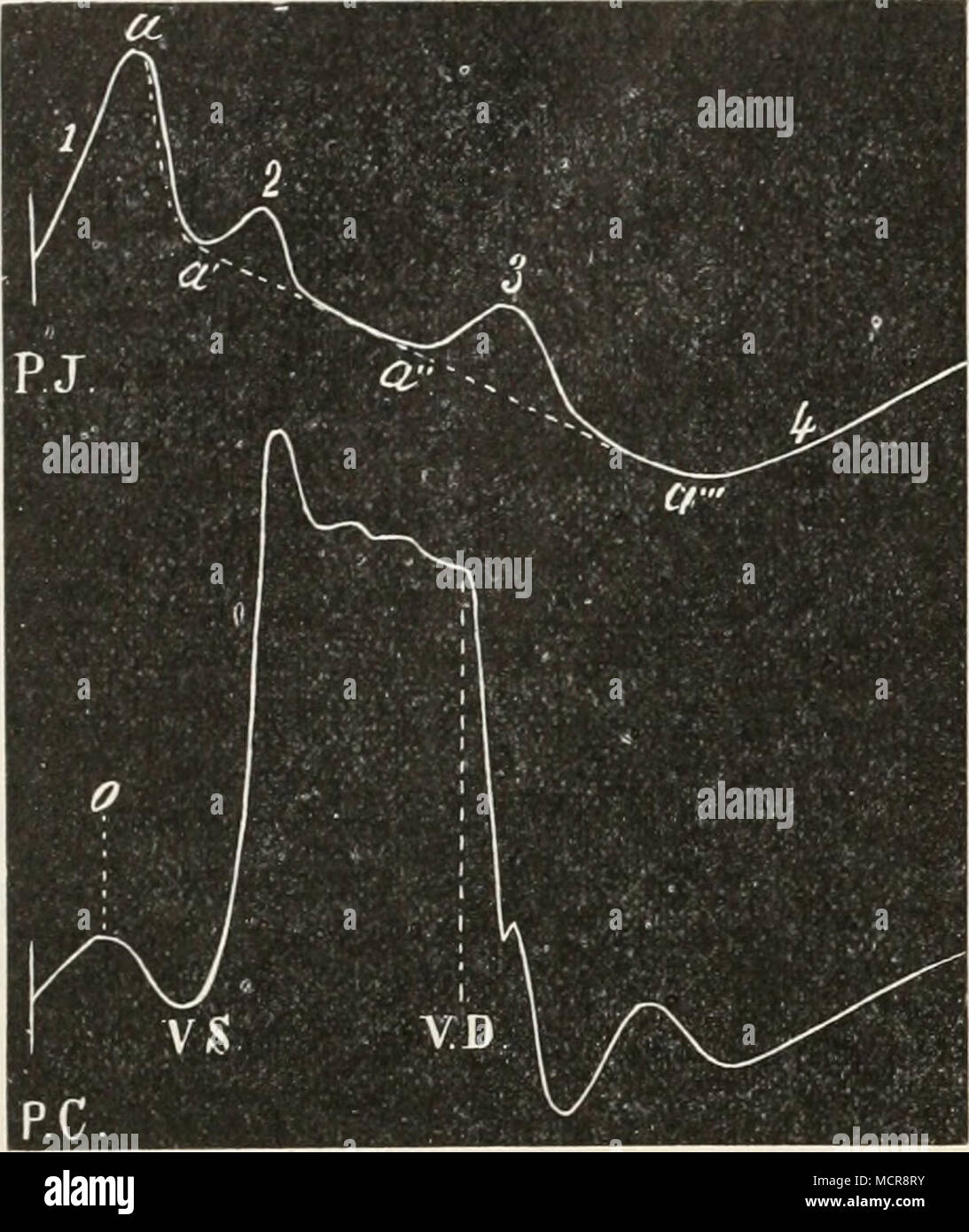 . Fig. 472. Schema des normalen Jugularis- pulses. Nach Frangois-Franck ...