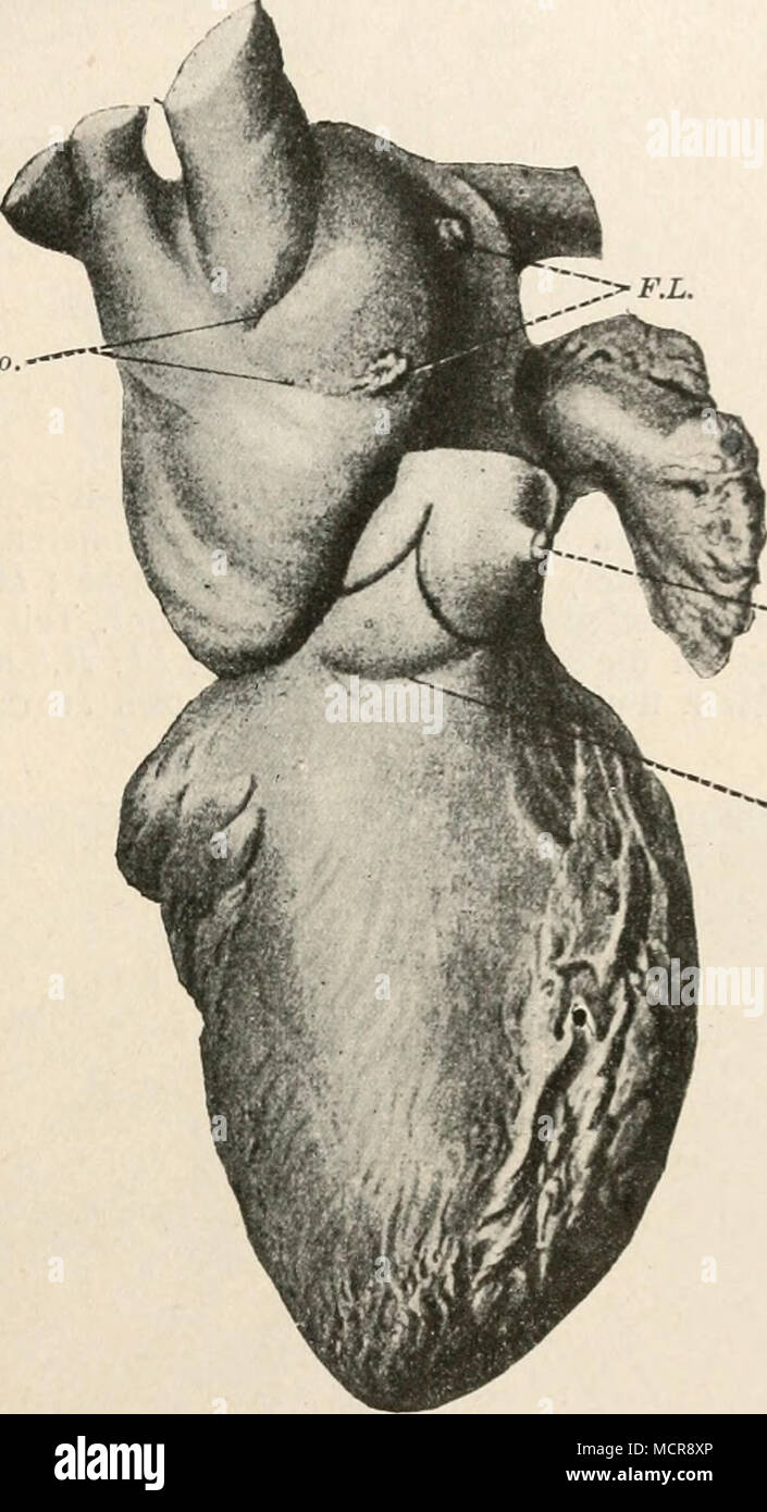 . Fig. 59. Abguß des linken Herzens von der septalen Seite gesehen ...