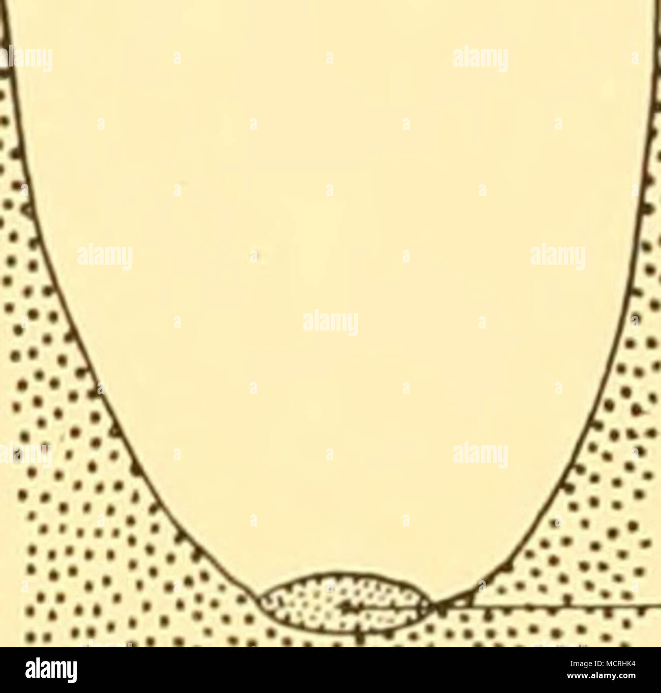 . -photc.d.a. but at a level just proximal to the nerve ending. Both ...