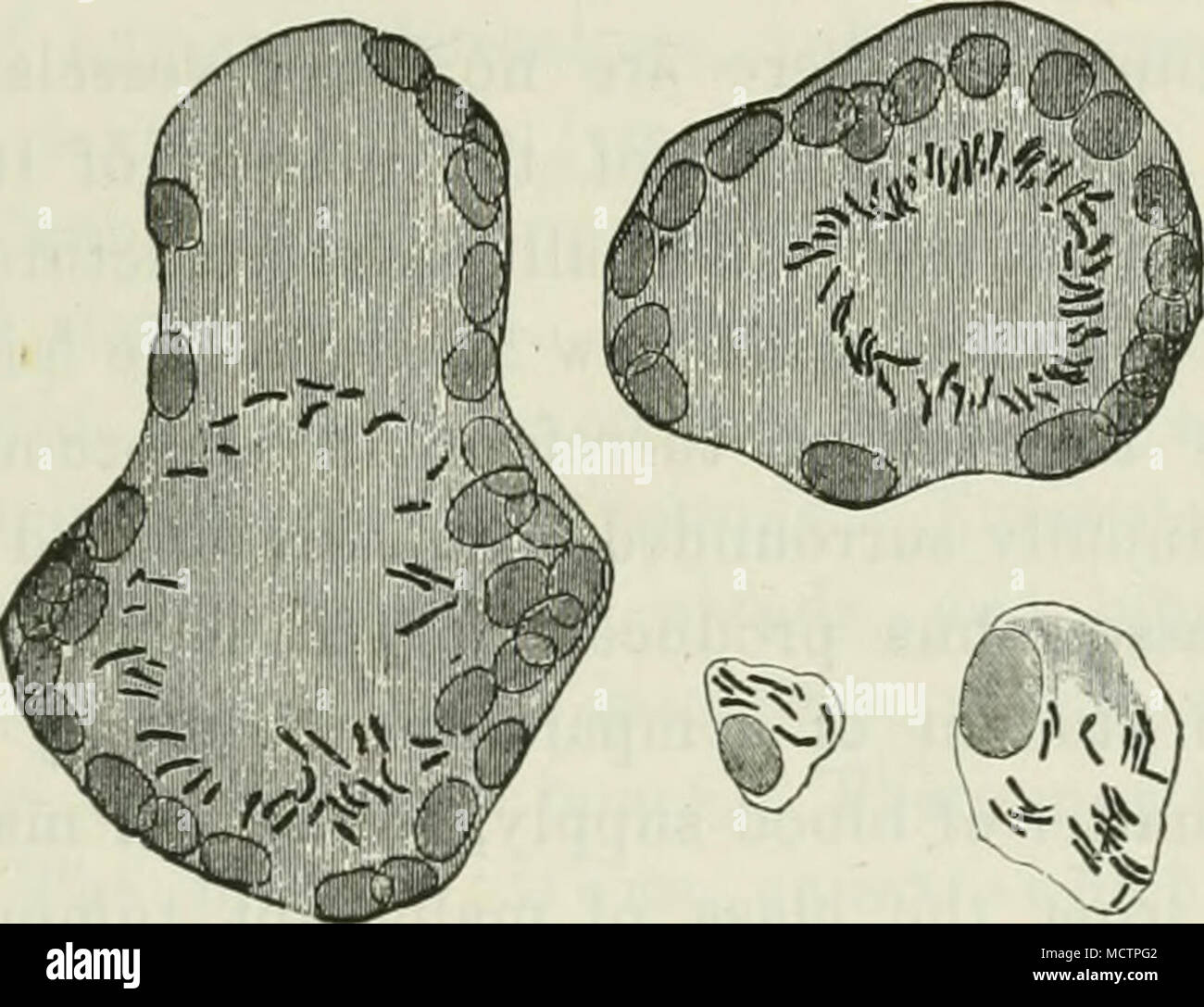 . Fig. 25. From a section through tuberculous deposits in the lung of a ...