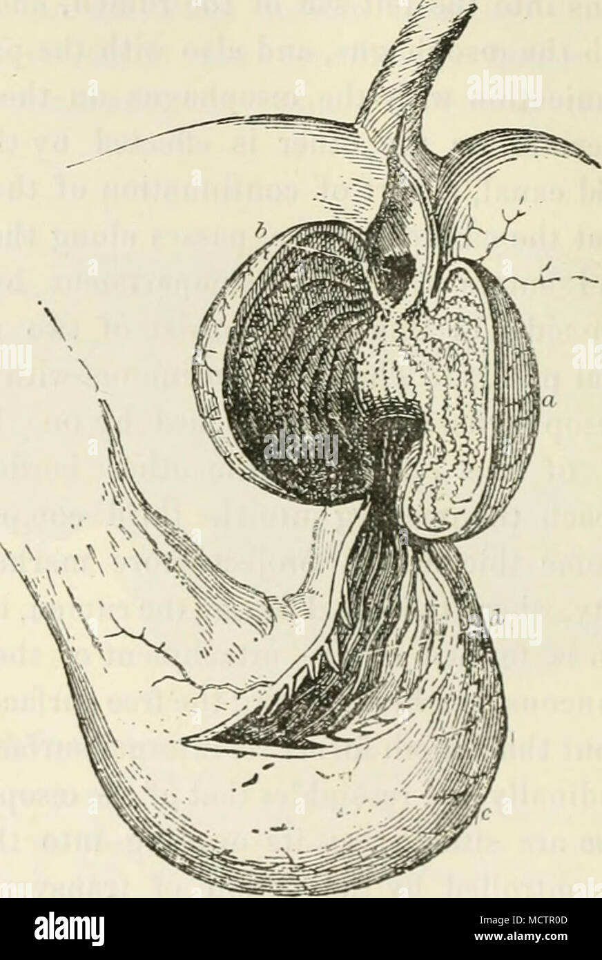 Stomach fissure hi-res stock photography and images - Alamy