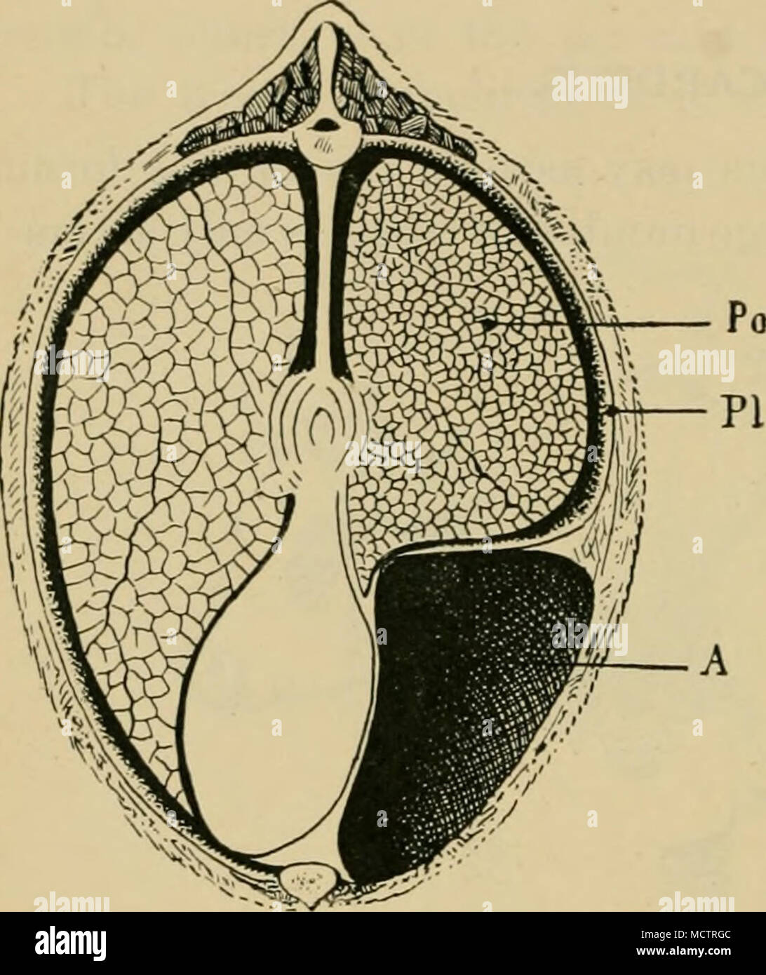 . Fig. 181. — Schema of a subpleural abscess on the right side which ...