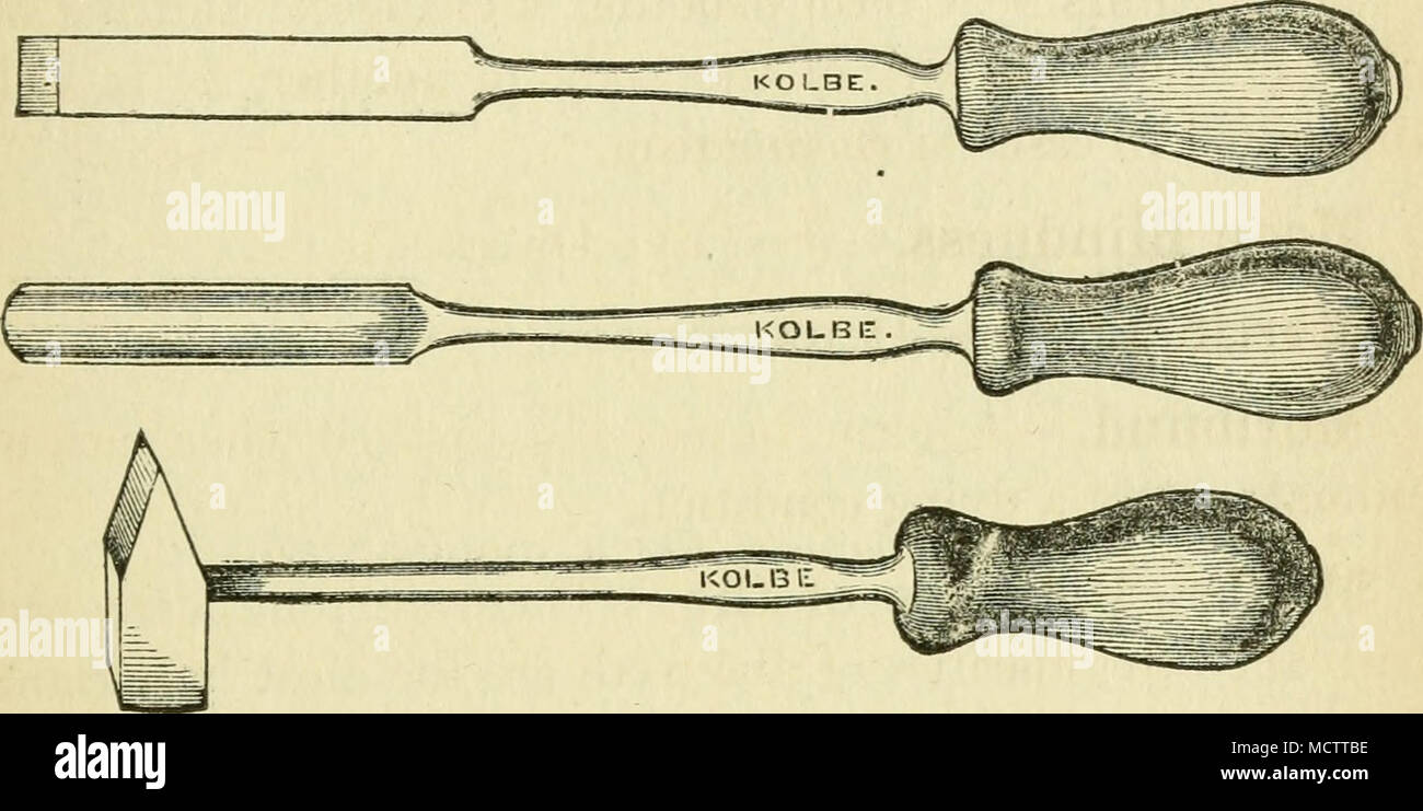 . TOOTH CHISEL, RASP AND HAMMER. (2.) Wounds of the Tongue.—Should be ...