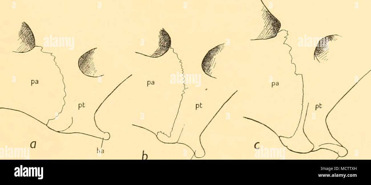 Pterygoid process hi-res stock photography and images - Alamy