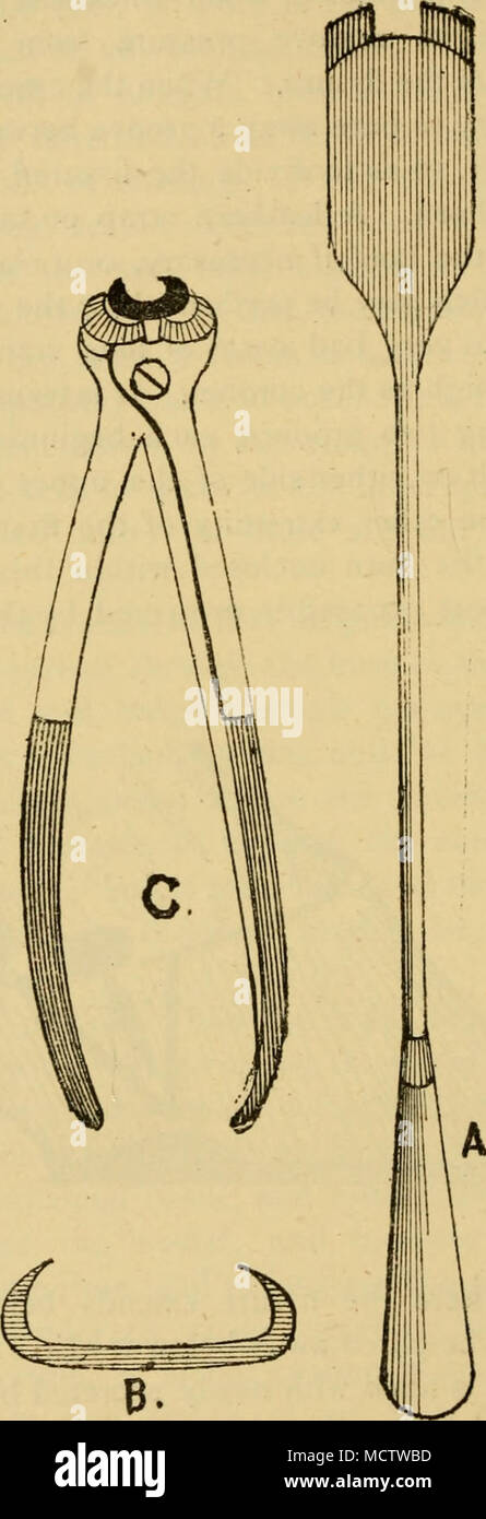 . (After Signol). It is best to use a number of clasps placed at a ...