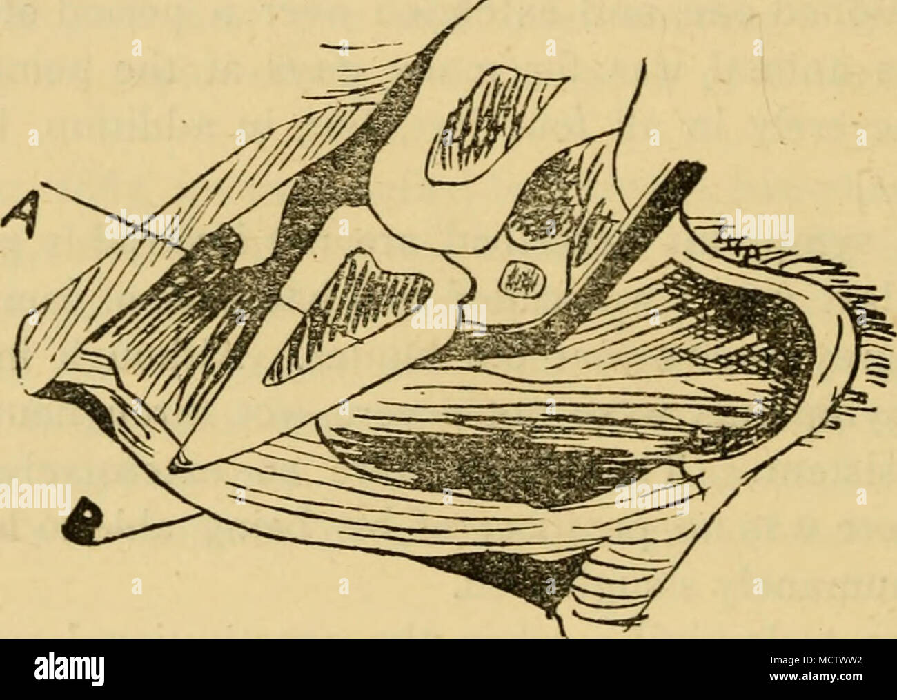 . The above picture is a section of a pumiced foot, showing (A) the ...