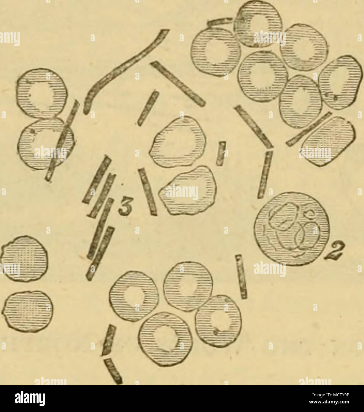 . Heart's Blood of a jMouse dead of Anthrax. 1. Blood-discs. " 2 ...