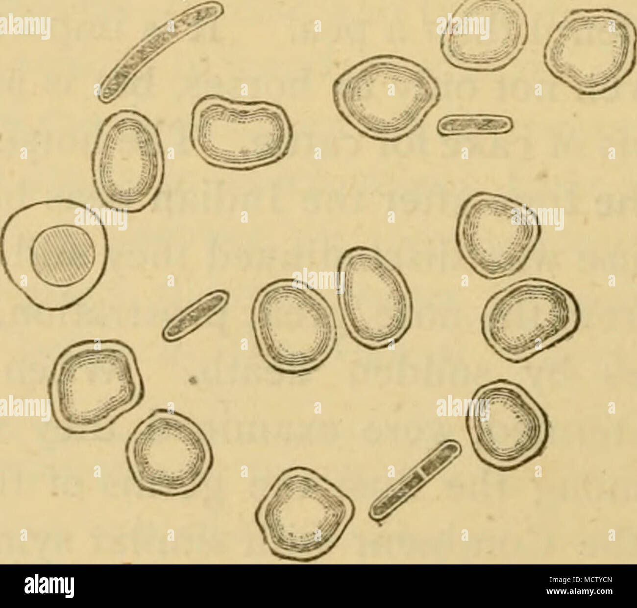 . Blood OF a Guinea-pig dead of Symptomatic Anthrax. Blood-corpuscles ...