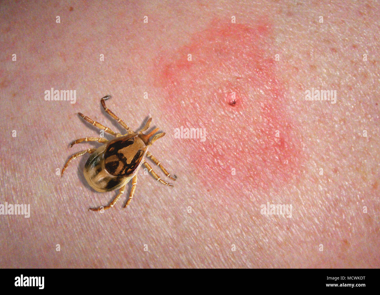 Australian Wounded High Resolution Stock Photography and Images - Alamy