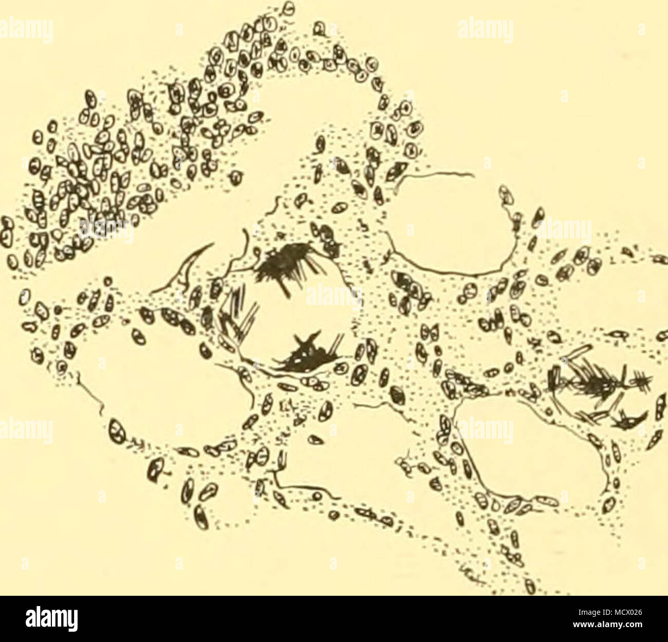 . Fig. 113. Blubber cells with blood crystals at the edge of the ...