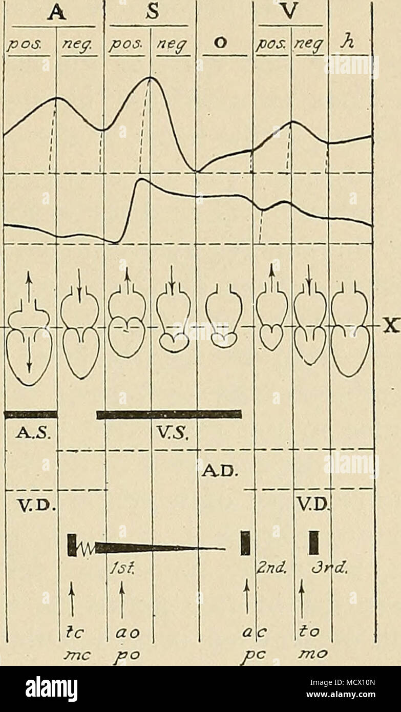 Carotid Pulse Tracing
