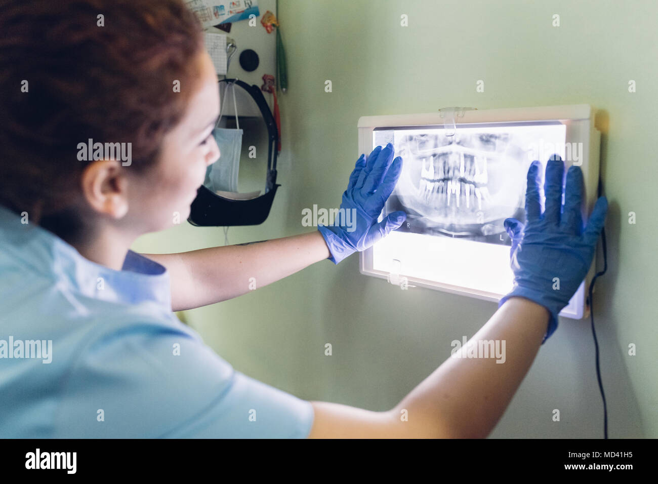 Female dentist looking at dental x-ray on lightbox Stock Photo - Alamy