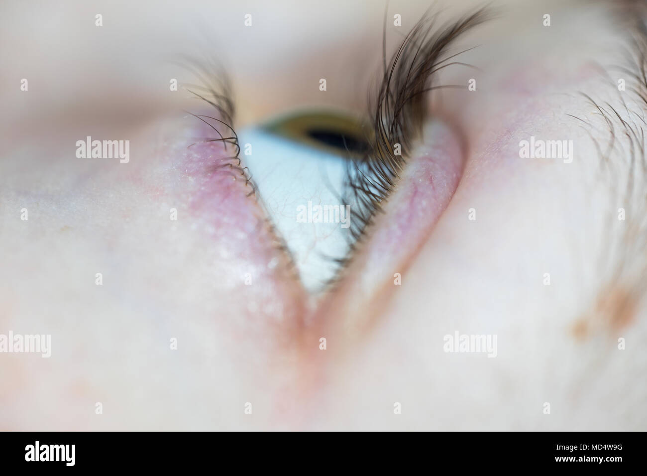Eye looking up hi-res stock photography and images - Alamy
