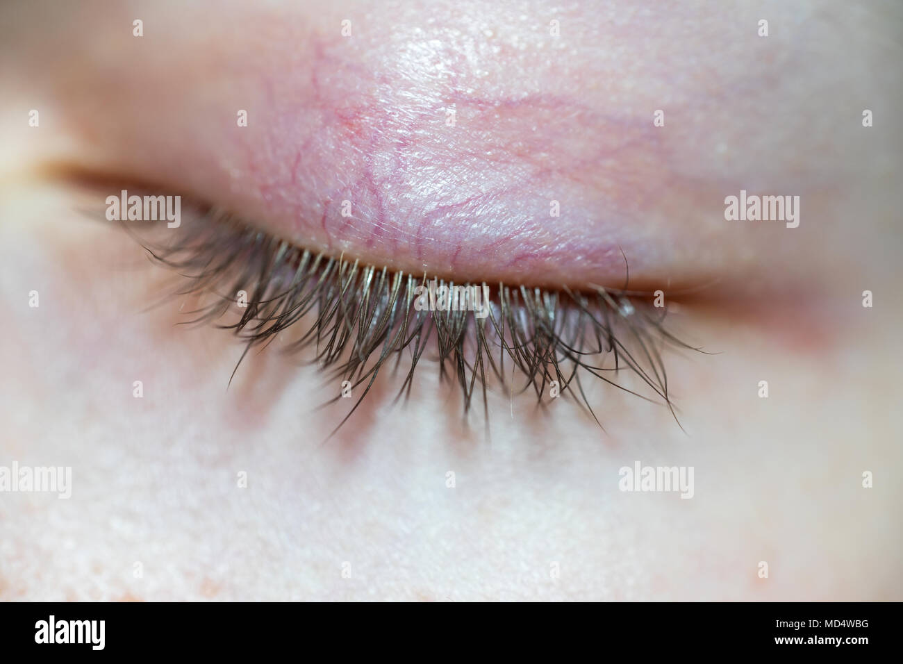 Long eyelashes hi-res stock photography and images - Alamy