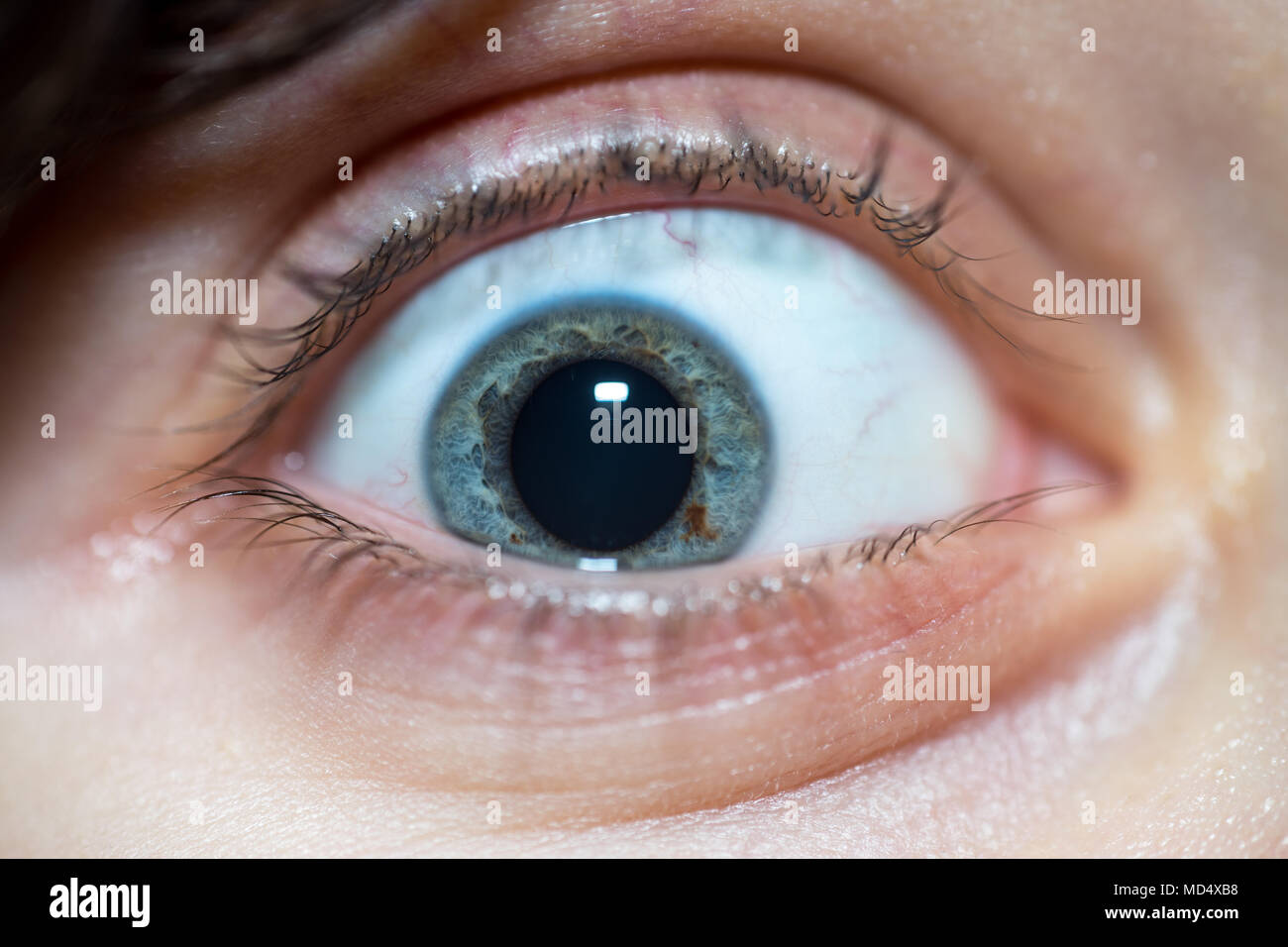 Close-Up Of Beautiful Blue Woman With Crazy Eye Staring At Camera ...