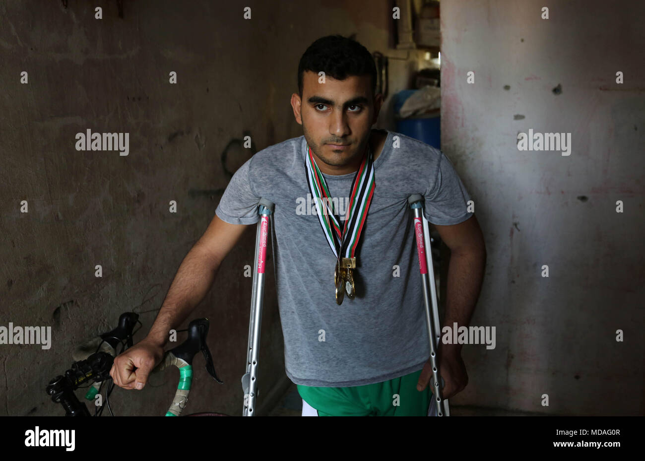 Shattered leg hi-res stock photography and images - Alamy